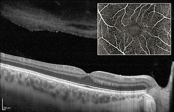 First SPECTRALIS OCT2 delivered | Heidelberg Engineering Ltd.