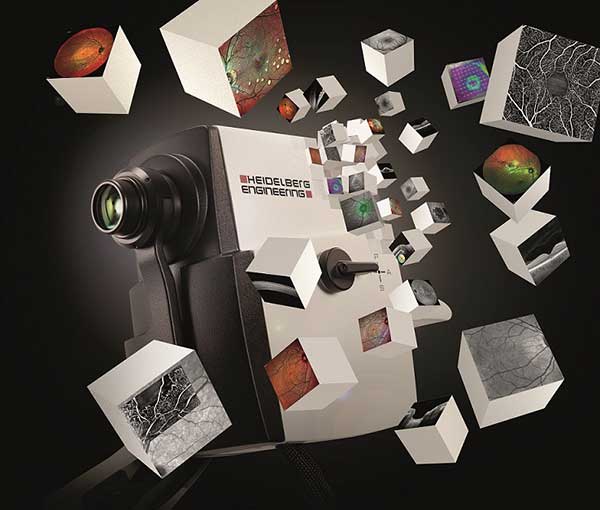 Global response to the OCT2 module | Heidelberg Engineering Ltd.