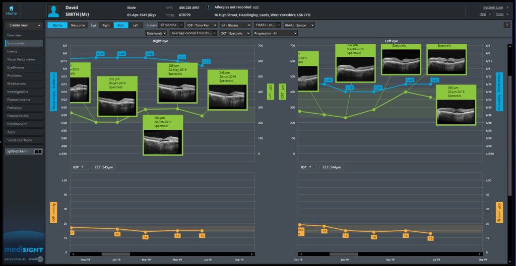 Heidelberg Engineering and Medisoft – Research Hub – Updated for 2023 ...